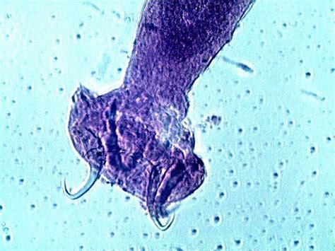 Class Monogenea An Overview Examples Life Cycle Characteristics