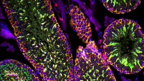 Fluorescence Microscopes Keyence America