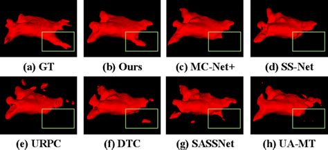 Figure 5 From Dual Decoder Consistency Via Pseudo Labels Guided Data Augmentation For Semi