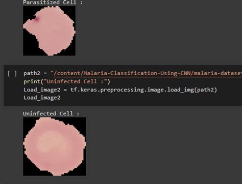 github toof04 malaria detection ml classification of rbcs if they