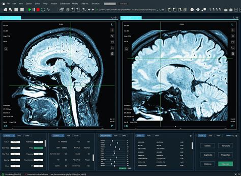 Brain Cognitive Decline Age Related Loss Identified Newsylist