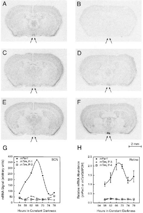 Structure Of Suprachiasmatic Nucleus Semantic Scholar