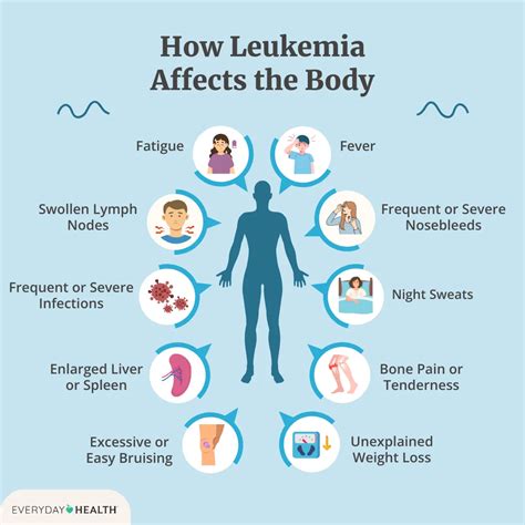Early Signs Symptoms Of Leukemia In Females