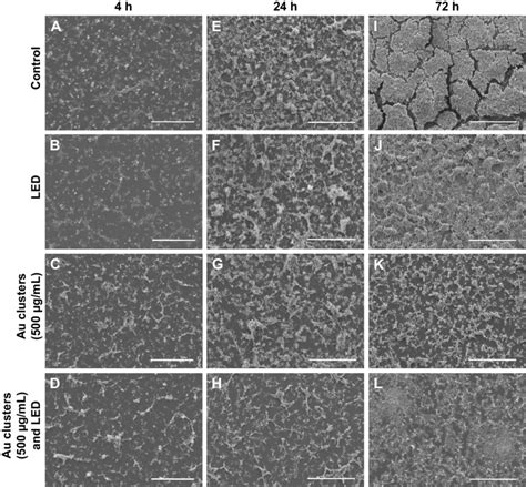 Sem Observation Of Streptococcus Mutans Notes A L Sem Micrographs Download Scientific