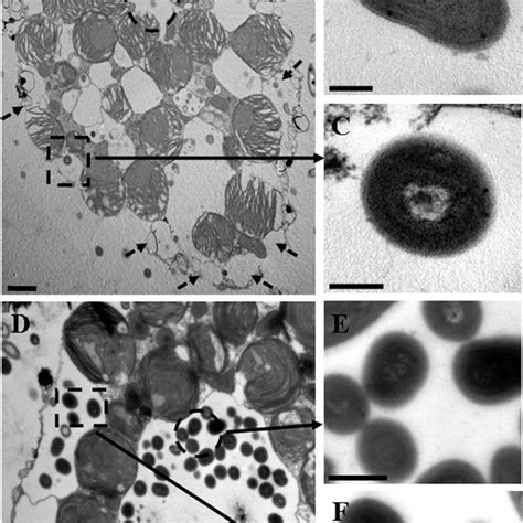 Feeding Processes Of Raphidophyte On A Living Synechococcus Sp Cell