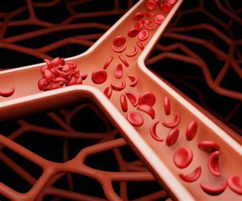 750 Anemia Sel Sabit Foto Foto Stok Potret And Gambar Bebas Royalti