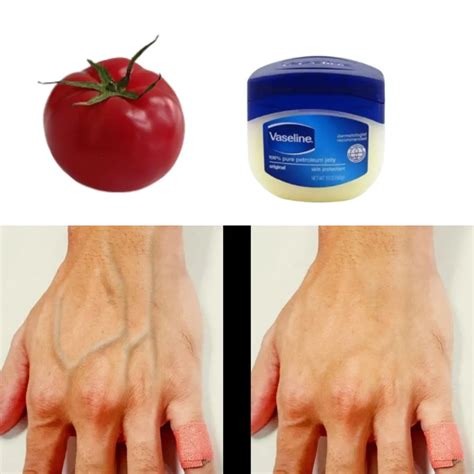 5 Simple Ways To Make Hands Look Younger And Rejuvenate Your Skin