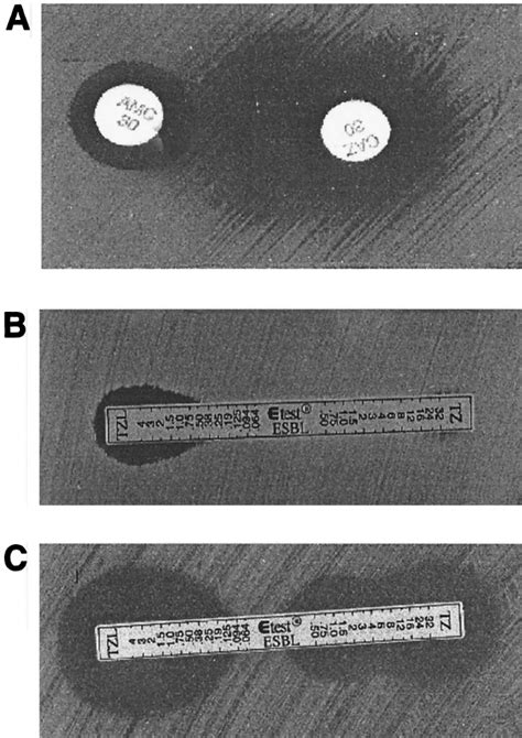 Double Disk Diffusion And Etest Esbl Detection Tests A The Download Scientific Diagram