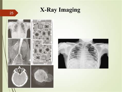 Lecture 1 For Digital Image Processing 2nd Edition Pptx Photo