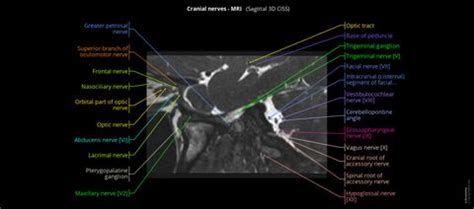 Anatomy Of The Cranial Nerves And Brainstem Annotated Mri E Anatomy