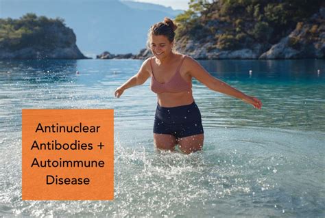 The Institute For Functional Medicine On Linkedin What Are Antinuclear