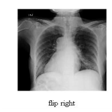 figure sample images after the data augmentation step download