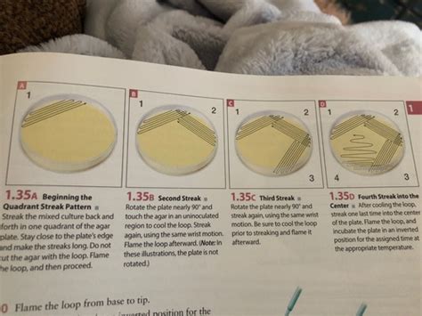 Week Micro Lab Quiz Flashcards Quizlet