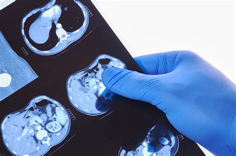 Premium Photo Medical Tomography Ct Results Exam Close Up Snapshot