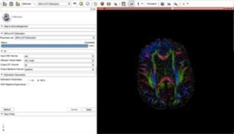 Osirix Lite Segmentation Lunchgas