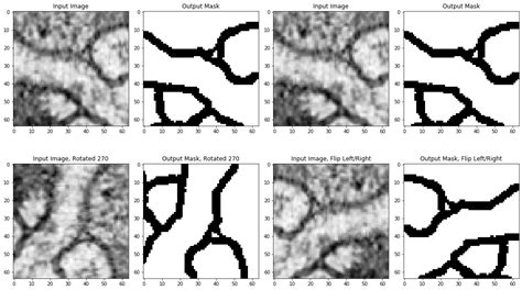 The U Net Architecture Abbies Ai Tutorials