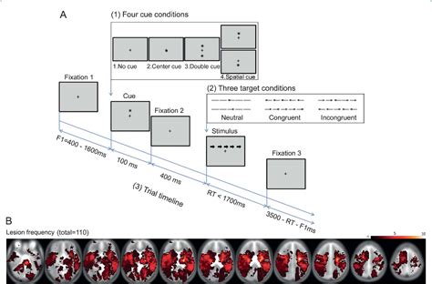 Figure 1 From Triple Dissociation Of Attention Networks In Stroke