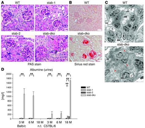 JCI Deficiency Of Liver Sinusoidal Scavenger Receptors Stabilin 1 And