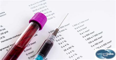 Platelet Count Plt Test Portland Oregon