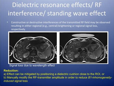 Distortion Artifacts In Mri And Their Correction Ppt Digital Audio Computer Software And