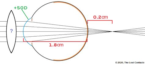 The Optics Of Vision Lesson 7 Hyperopia The Lost Contacts