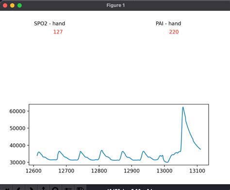 Github Wasdwasd0105 Nonin3150 Ble Python A Python Program Can Receive Record And Plot Nonin