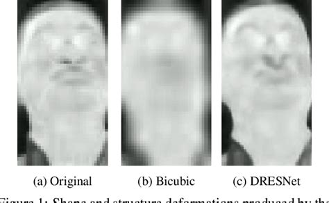 Figure 1 From Improving Accuracy Of Respiratory Rate Estimation By