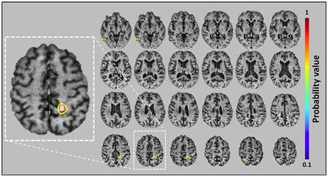 Deep Learning Enables Automatic Detection And Segmentation Of Brain