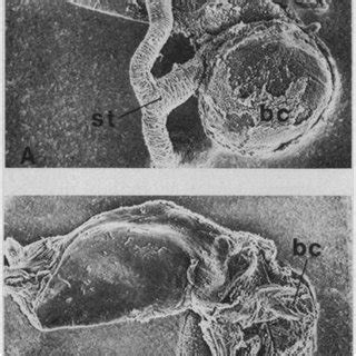 Scanning Electron Micrographs Of Female Internal Reproductive Tract And Download Scientific