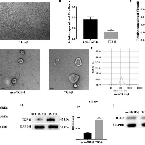 Emt Induced Exosome Characteristics Of Crc Cells A Representative