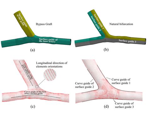 surface guides needed to define the element orientations of the bypass