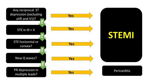 Stemi Vs Pericarditis Ecg Stemi Vs Pericarditis Ecg