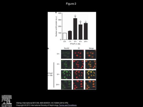 Parathyroid Hormonerelated Protein Protects Renal Tubuloepithelial
