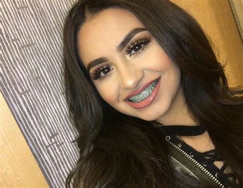 Pin By Nae Nae On Brace Face Brace Face Cute Braces Cute Girls With