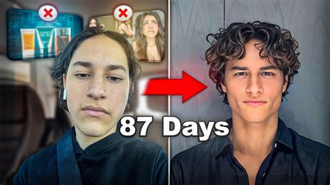 A Comprehensive Guide To Developing Your Bone Structure For Health And