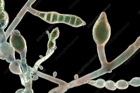 Microsporum Audouinii Fungus Illustration Stock Image F036 7222 Science Photo Library