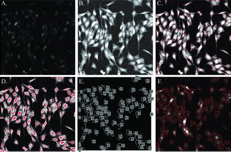 Progression Of The Matlab Algorithm For Cell Segmentation And