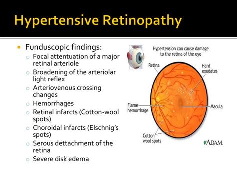 Ppt Case 3 Powerpoint Presentation Id2121758