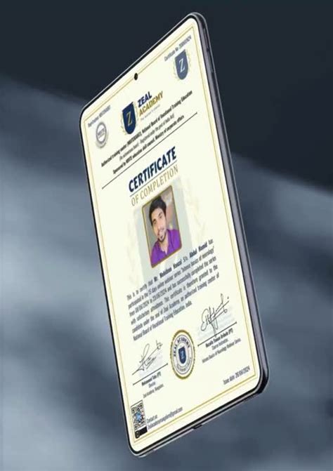 Mohideen Hanzal On Linkedin Neurology Physiotherapy