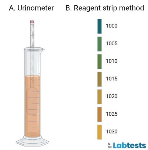 Urine Specific Gravity Test Principle Normal Values Method