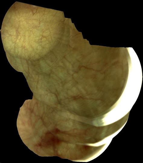 A 1258 × 1436 Panoramic Image Constructed From A 400 Consecutive Frames Download Scientific