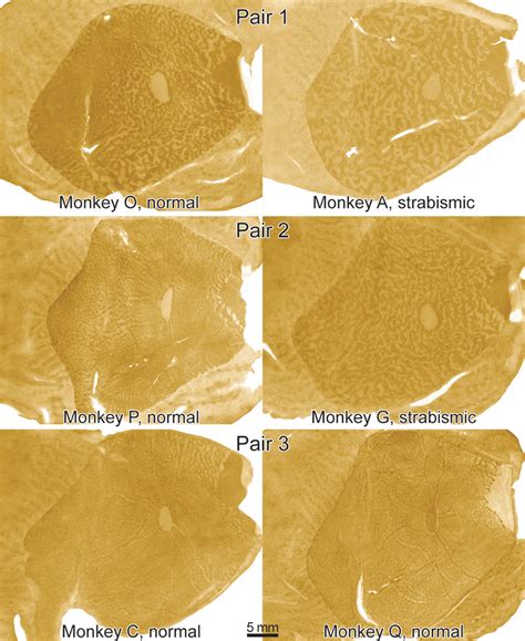 Ocular Dominance Columns In Strabismus Visual Neuroscience Cambridge Core