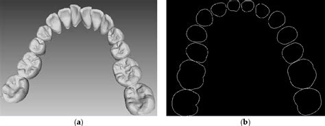 Figure 9 From Tooth Segmentation Of 3d Scan Data Using Generative Adversarial Networks