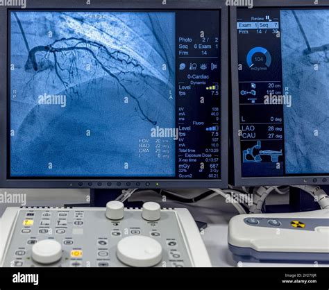 Istanbul Turkey 28 February 2024 Angiogram Sequence Working Clockwise Using X Rays With A