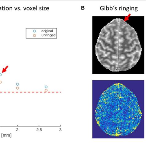 a scan rescan variability within the white matter at different