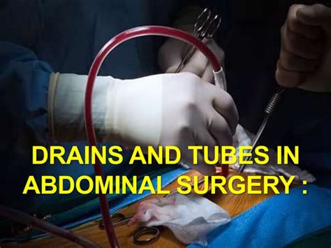 Different Types Of Drains In Surgeryppt
