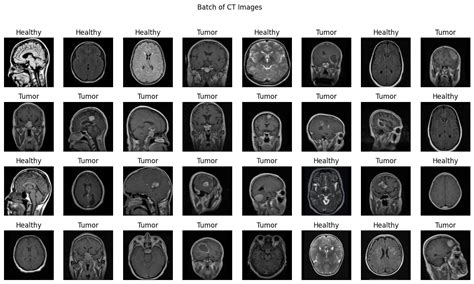 Neuromedic Deep Learning Based Mri Classification For Brain Tumor Detection By Adityan