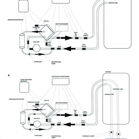 Development Of A Neonatal Respiratory Ecmo Program Timeline Of Key Download Scientific