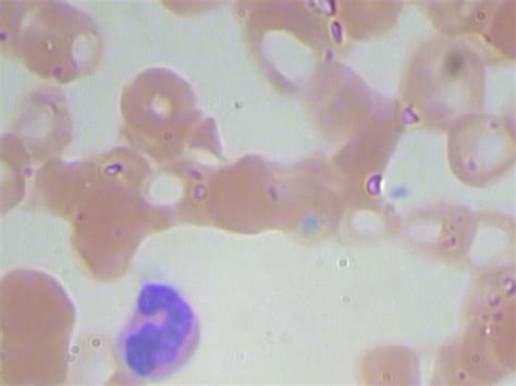 Bccd Autoencoder Embeddings Object Detection Dataset And Pre Trained Model By Workspaceone