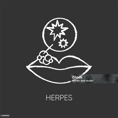 검은 배경에 헤르페스 분필 흰색 아이콘입니다 바이러스 성 피부 감염 전염성 성병 성병 부은 물집이 있는 입술 뾰루지 고립된 벡터 칠판 삽화 개념에 대한 스톡 벡터 아트 및